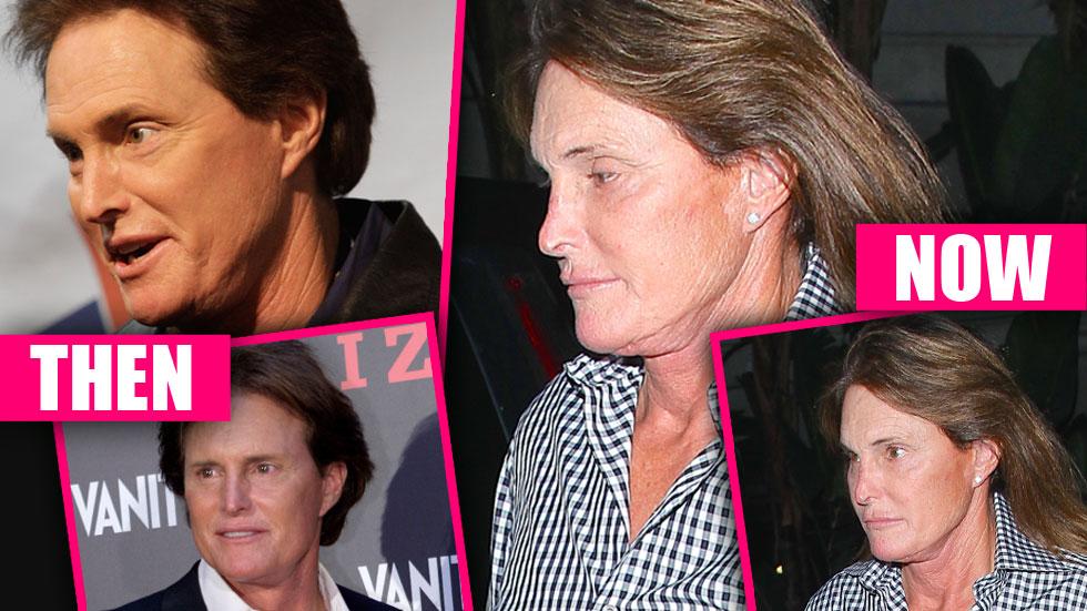 Nip/Tuck: Bruce Jenner Reportedly Gets Nose Job Before This Summer's ...