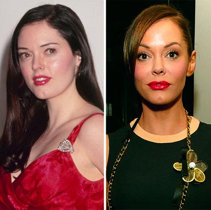 PHOTOS: Stars In Their 30’s Who Have Gotten Plastic Surgery