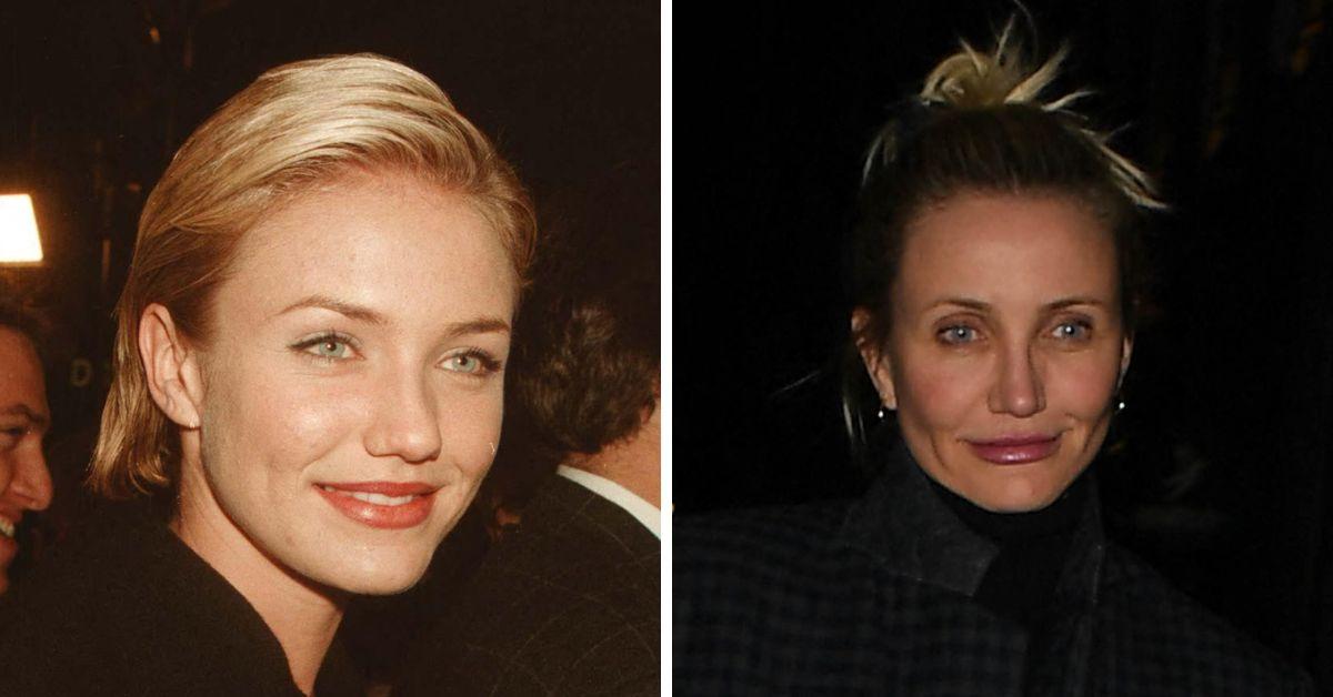 27 Hollywood Female Celebrities Who Had Nose Jobs