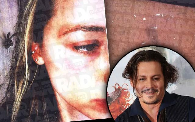 'Damage' & 'Injuries!' See The Photos Of Depp's Alleged 'Attack'