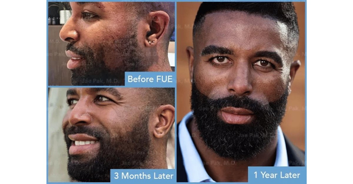 Honor Recommitment Month by Planning the Perfect Vow Renewal Ceremony ...