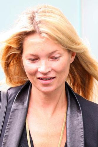 Nearly Unrecognizable! 20 Shocking Photos Of Stars Without Makeup