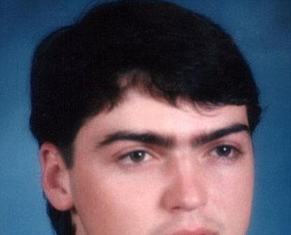 The Face Transplant Of Richard Lee Norris