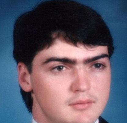 The Face Transplant Of Richard Lee Norris