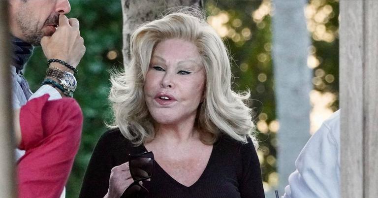 'Catwoman' Jocelyn Wildenstein Looks Unrecognizable Before Plastic ...