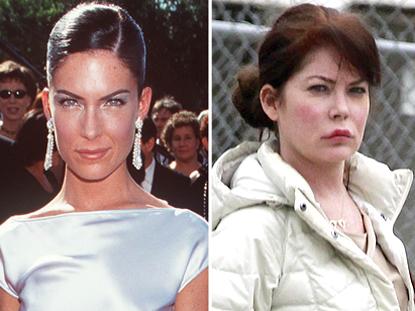 PHOTOS: 10 Celebrities Addicted To Plastic Surgery