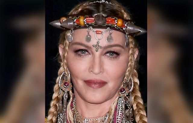 Madonna's Shocking Plastic Surgery Makeover Exposed By Top Docs