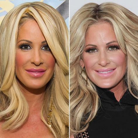 A Little Nip And Tuck? Kim Zolciak Has Had 'A Nose Job And Botox,' Says Surgeon