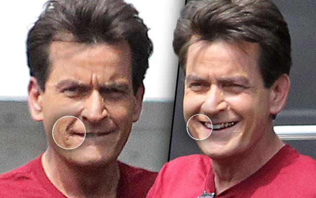 Charlie's Skin Appears To Show His Struggle With Deadly Disease