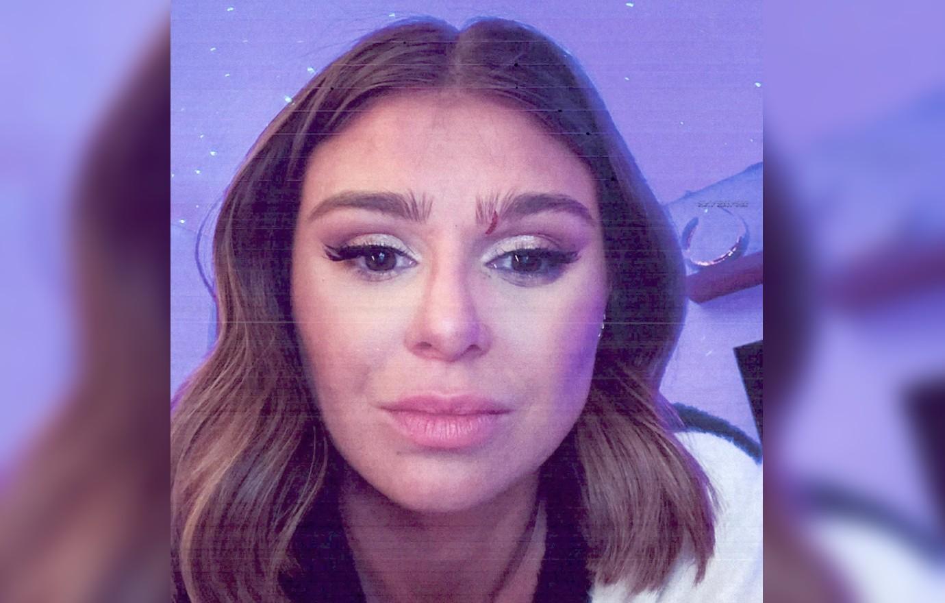 Raquel Leviss Shows Off Black Eye After Being 'Physically Attacked' By Scheana Shay