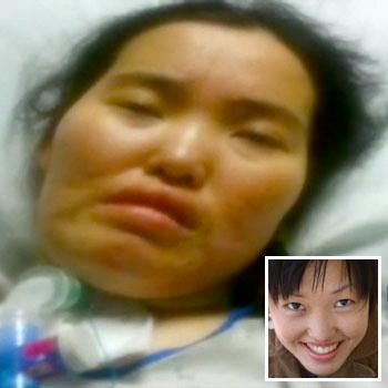 Grace Lee Decides To Remain On Life Support