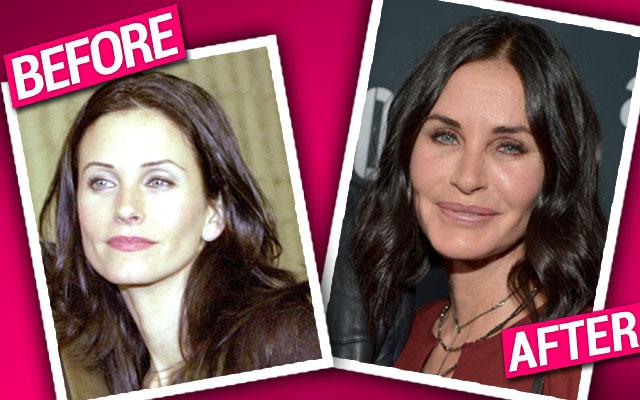 About Face! Courteney Cox 'Bit By The Surgery Bug'