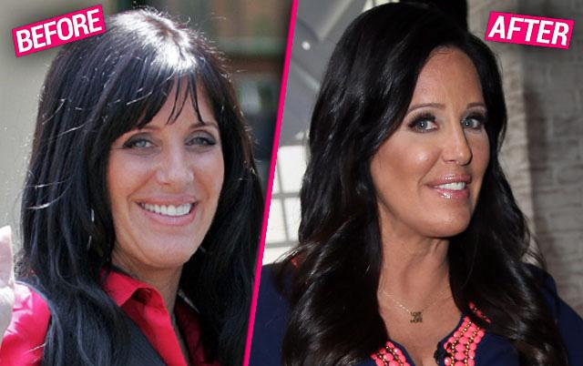 Millionaire Makeover! Patti Stanger's DRAMATIC Plastic Surgery Secrets ...