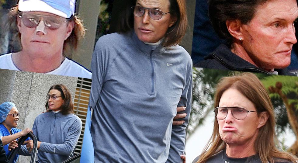 How He’ll Do It! Doctors Reveal Steps Bruce Jenner Will Likely Take In ...