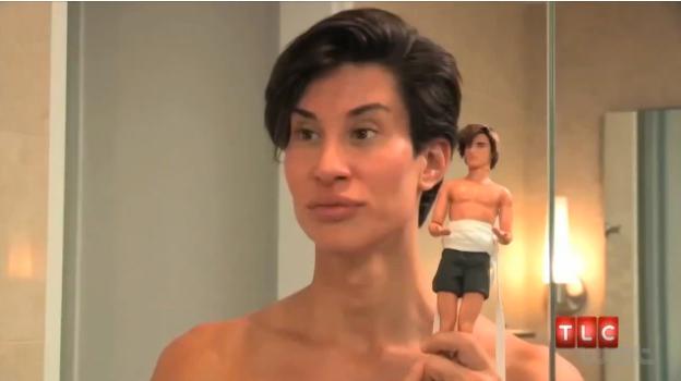 15 Extreme Real Life Plastic Surgery Disasters