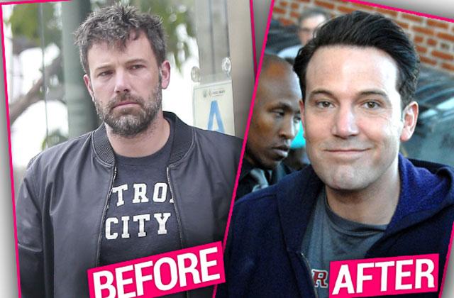 Secrets Of Ben Affleck's Freaky New Face Exposed