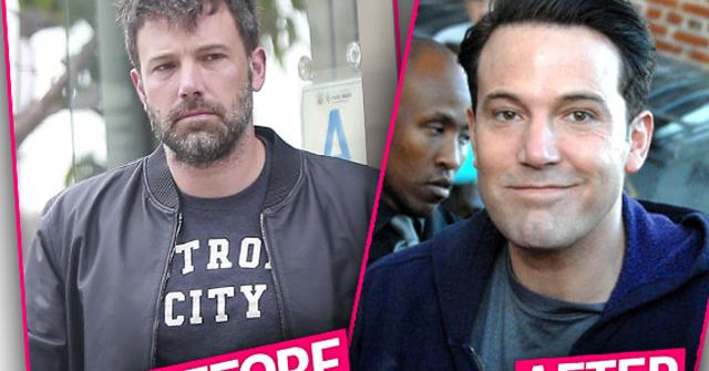 Secrets Of Ben Affleck's Freaky New Face Exposed