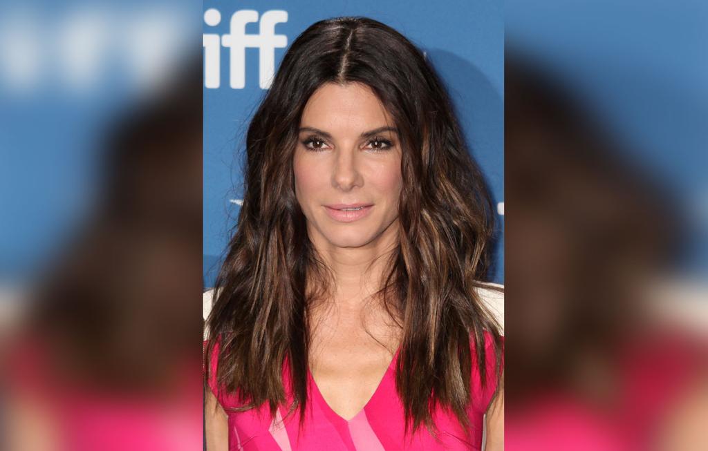 Sandra Bullock Fillers Puffy Cheek Fail