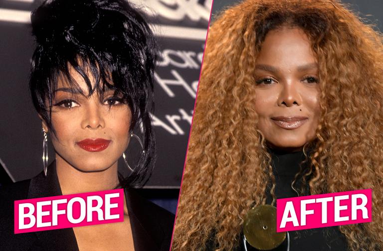 Janet Jackson Shocking Plastic Surgery Makeover Revealed