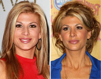 Celebrity Rhinoplasty! 10 Stars Who Have Gotten Nose Jobs