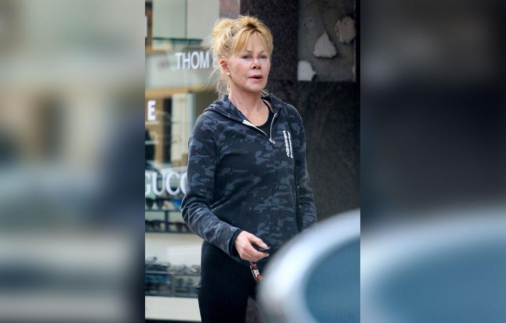 Melanie Griffith Wears Nose Bandage After Skin Cancer Treatment