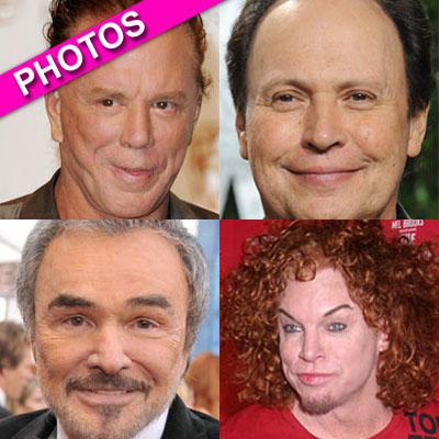 Not-So-Fantastic Plastic Men! 10 Celeb Guys Who’ve Gone Too Far Under ...