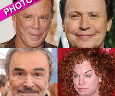 Not-So-Fantastic Plastic Men! 10 Celeb Guys Who’ve Gone Too Far Under ...