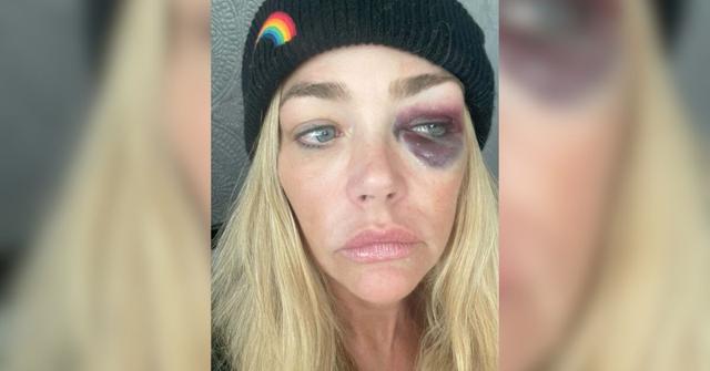 Aaron Phypers' Cousin Claims He 'Hit' and 'Choked' Denise Richards