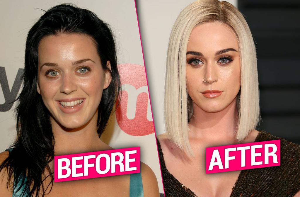 Katy Perry’s Plastic Surgery Lies? Star's Had Work Done, Top Docs Say