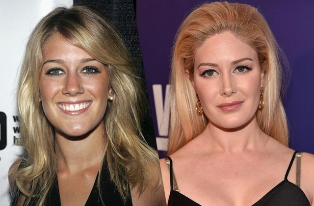 Facelifts! Botox! Stars With Freaky Faces After Botched Plastic Surgery ...