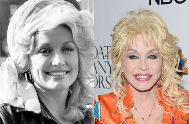 Dolly Parton Botched Botox