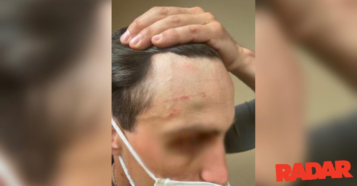 PHOTOS: Lindsie Chrisley's Ex Shows Off Alleged Assault Injuries