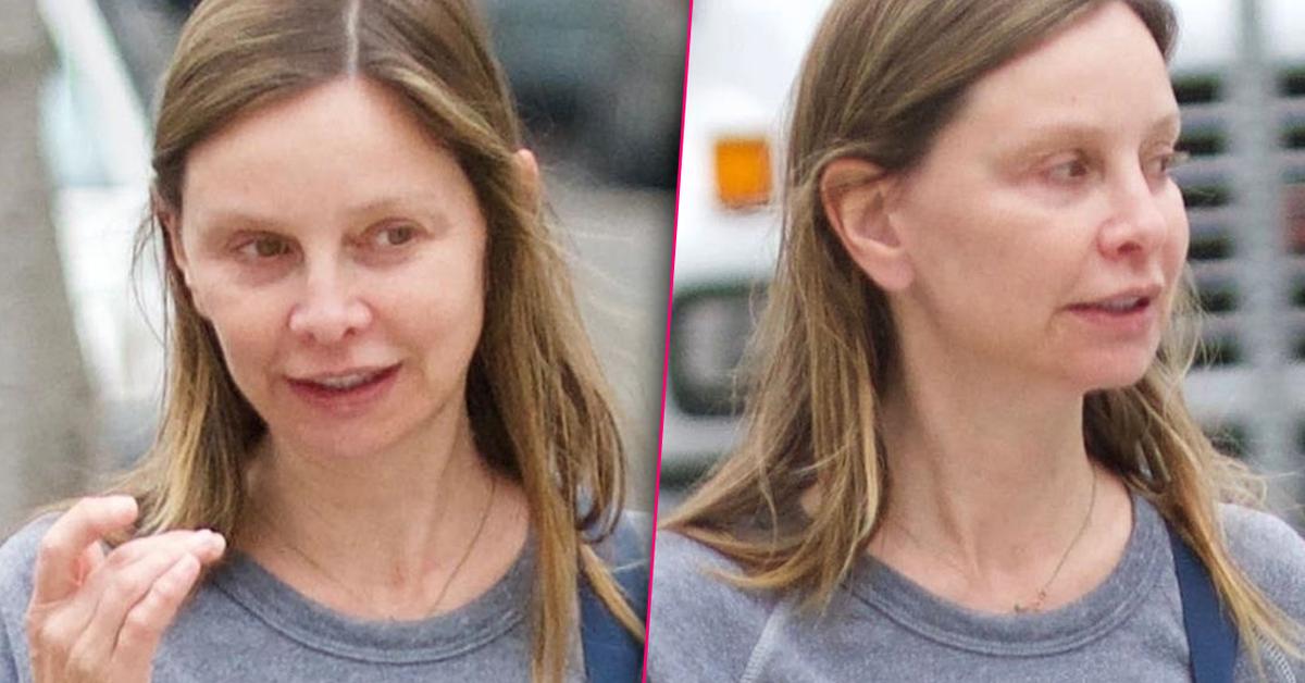 Calista Flockhart Caught With Nutty New Chipmunk Cheeks