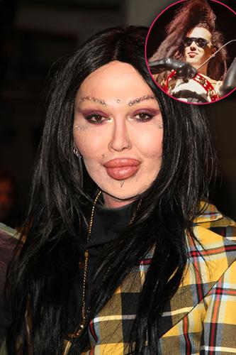 18 Extreme Real Life Plastic Surgery Disasters