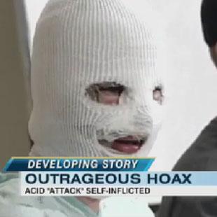 VIDEO: Woman Admits Throwing Acid On Her Own Face - But Why?