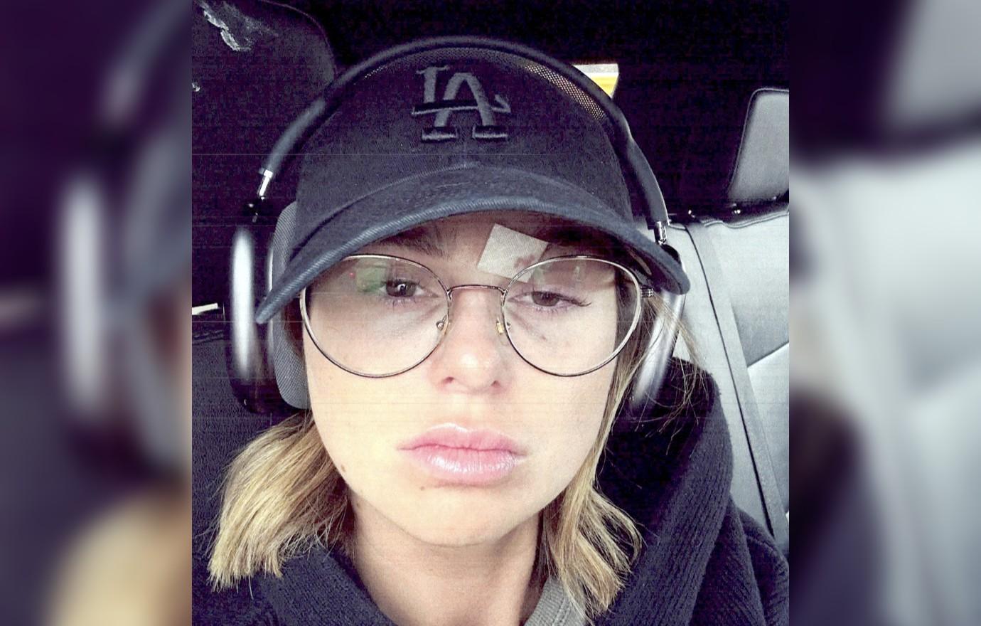 Raquel Leviss Shows Off Black Eye After Being 'Physically Attacked' By Scheana Shay