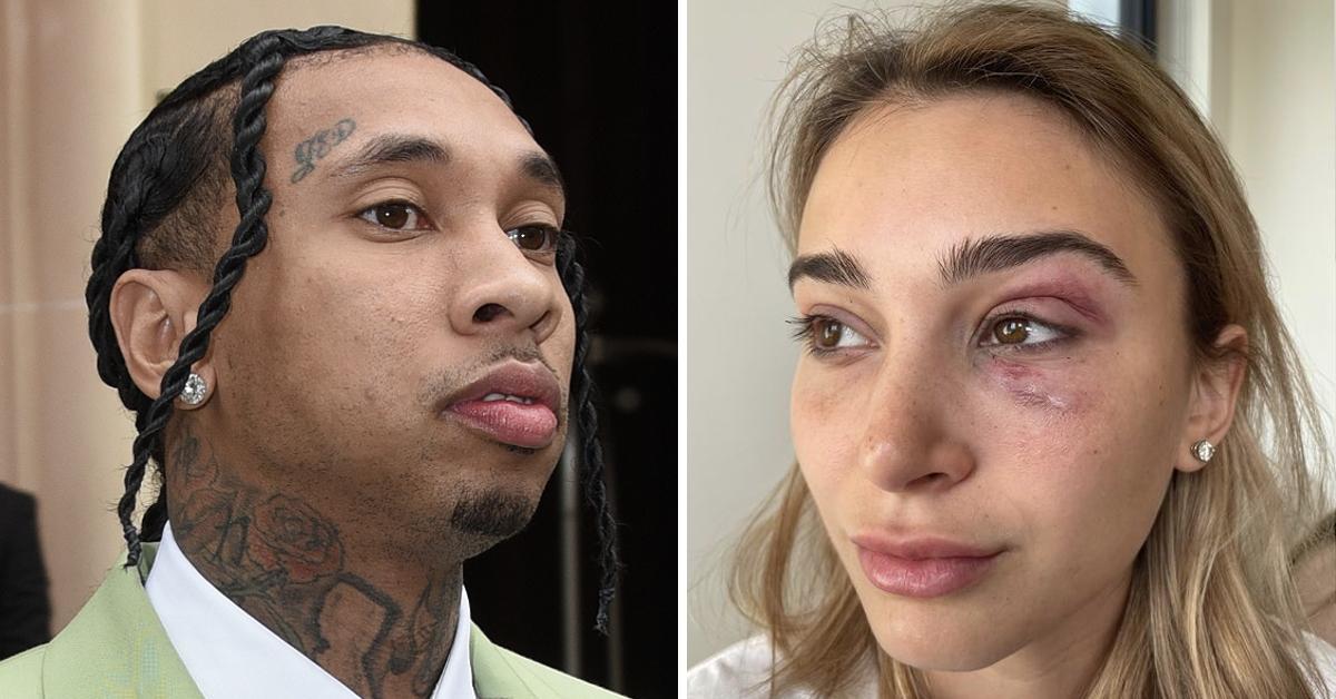 Tyga Will Not Be Charged In Domestic Violence Case Over Alleged ...