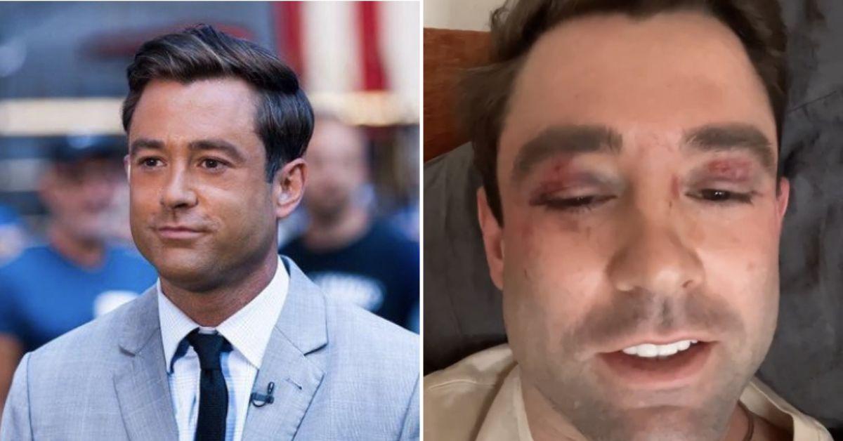 Fox News Weatherman Adam Klotz Attacked By Teenagers On Nyc Subway