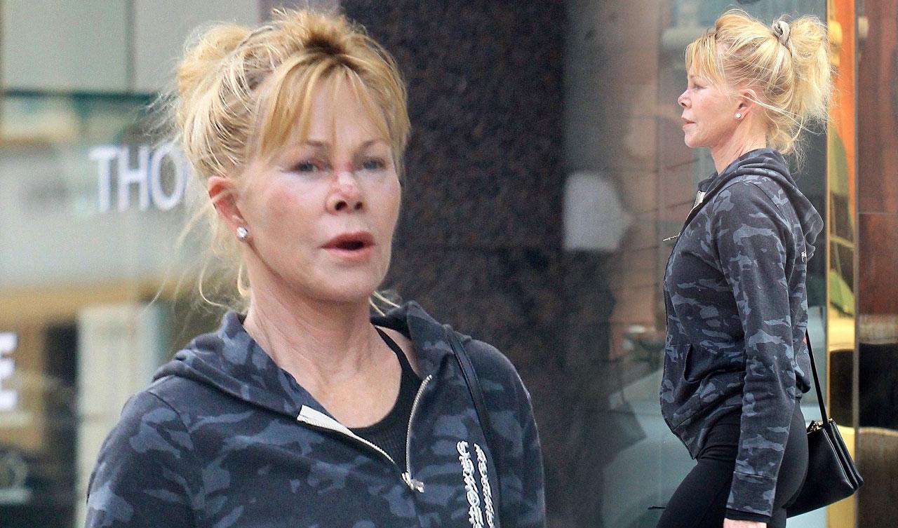 Melanie Griffith Wears Nose Bandage After Skin Cancer Treatment
