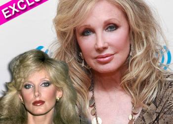 Morgan Fairchild Has Definitely Overdone The Filler Says Plastic Surgeon
