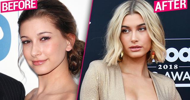 Hailey Baldwin S Plastic Surgery Revealed By Top Doctors