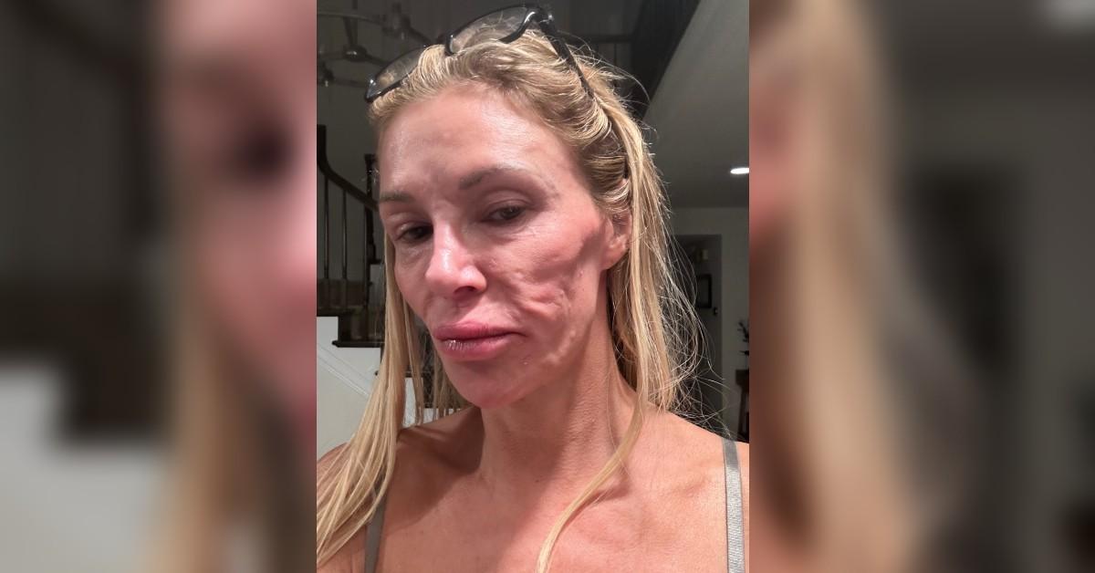 ‘Botched’ Surgery Expert Issues Bleak Warning to Tormented ‘Housewives ...