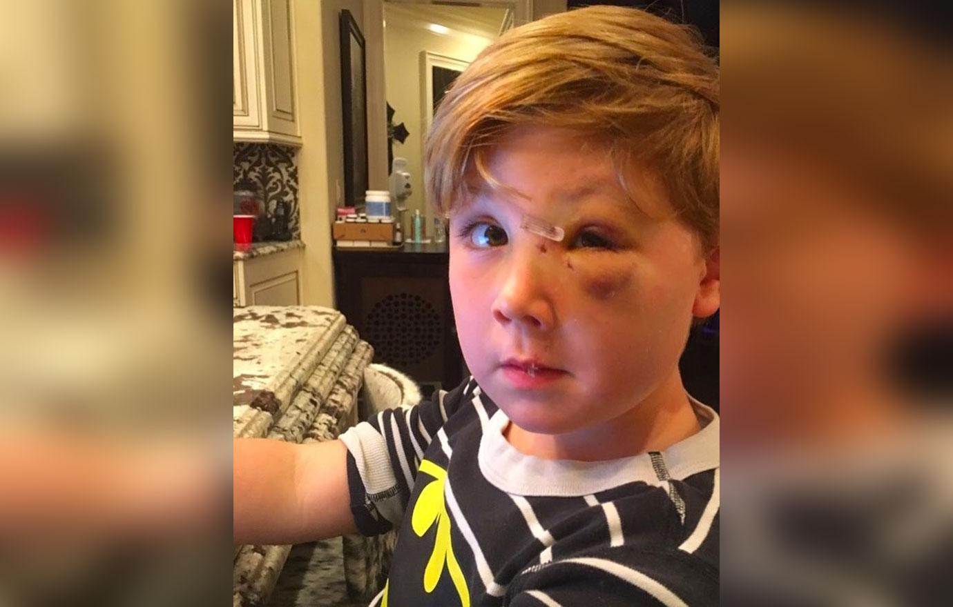 [VIDEO] Kim Zolciak’s Son Kash Biermann Plays With Animals & Visits Plastic Surgeon After ...