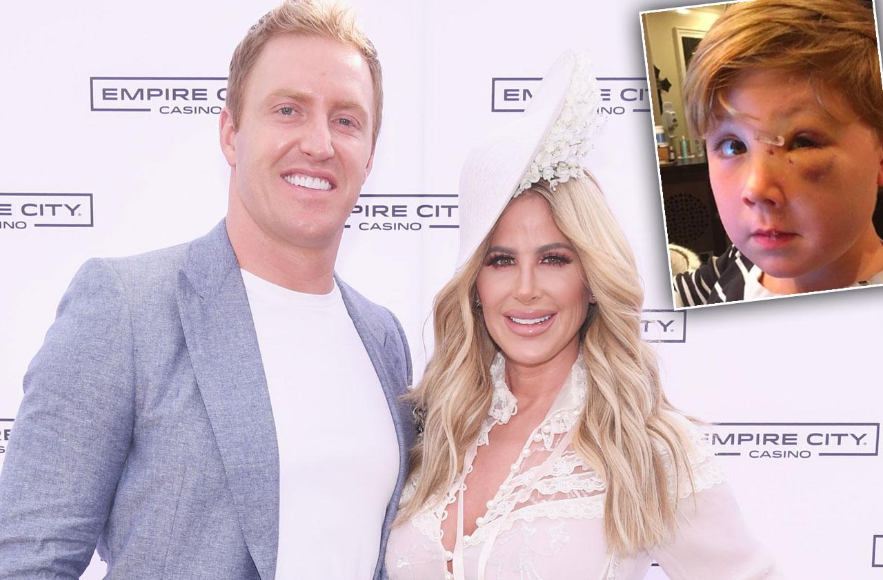 [PICS] Kroy Biermann & Kim Zolciak Skip Town Amid Kash’s Dog Bite & Lawsuit