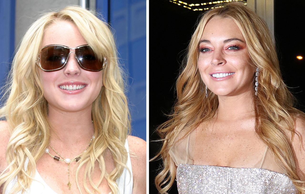 Shop Byte To Improve Your Smile Like Your Favorite Celebs