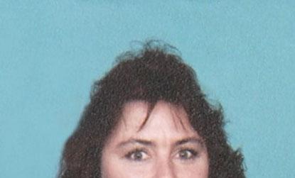 Connie Culp Before And After