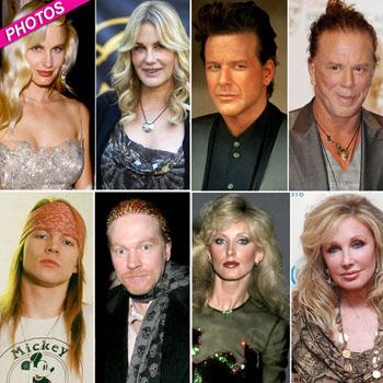 Plastic Surgery Icons? Sex Symbols Of The 70s & 80s Rumored To Have ...