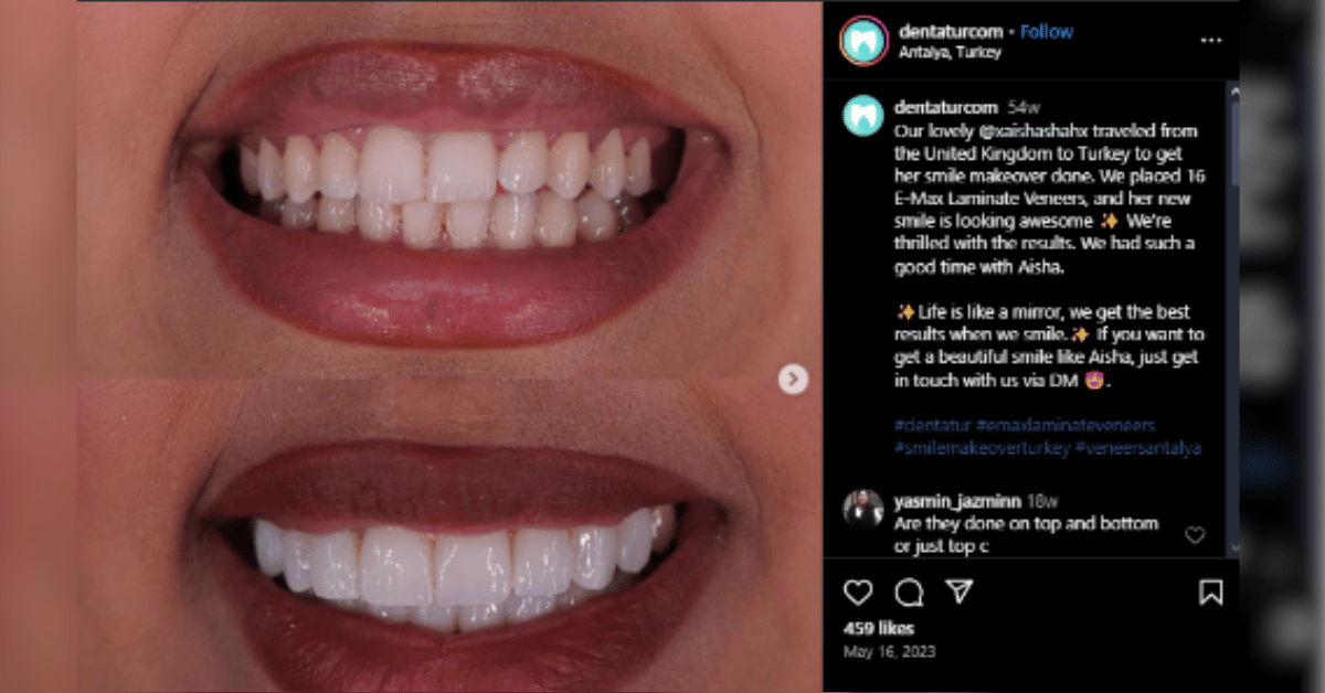 Dental Diaries of Influencers: From Imperfect to Irresistible Smiles