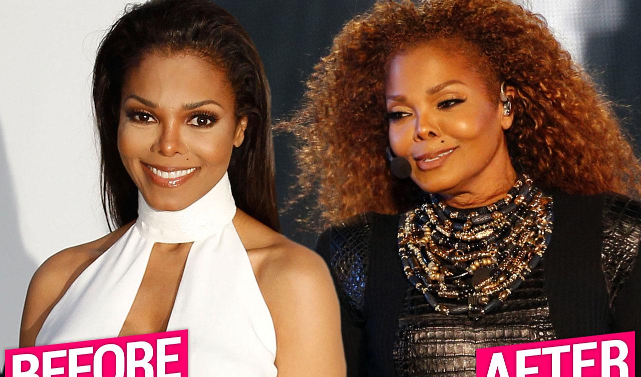 Janet Jackson Unrecognizable After Massive Plastic Surgery Makeover