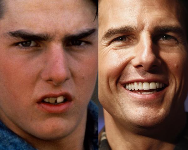 They May Be Beautiful But These Celebs Were Given A Bad Set Of Chompers